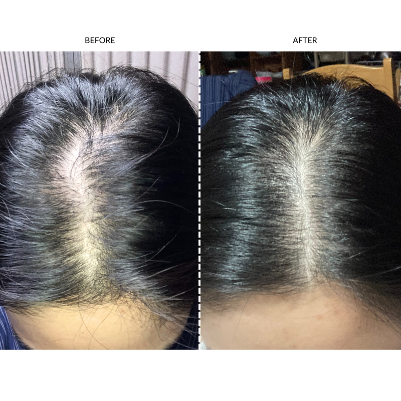 Red Light Therapy for Hair Loss | LED Hair Growth Helmet | CurrentBody ...